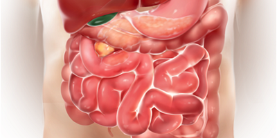 ASGE | Endoscopic Mucosal Resection (EMR)